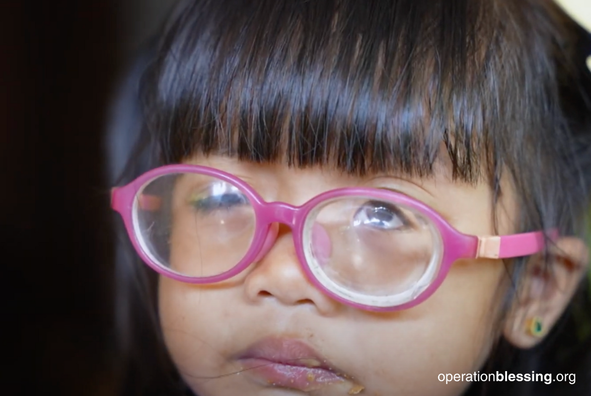Help for Young Girl Suffering with Childhood Cataracts - Operation Blessing